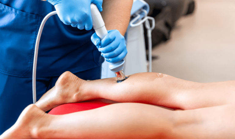 Radiofrequency Ablation Varicose Vein Treatment In Dubai