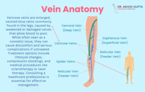 Dilated Tortuous Blue Veins In Legs: Causes And Treatment