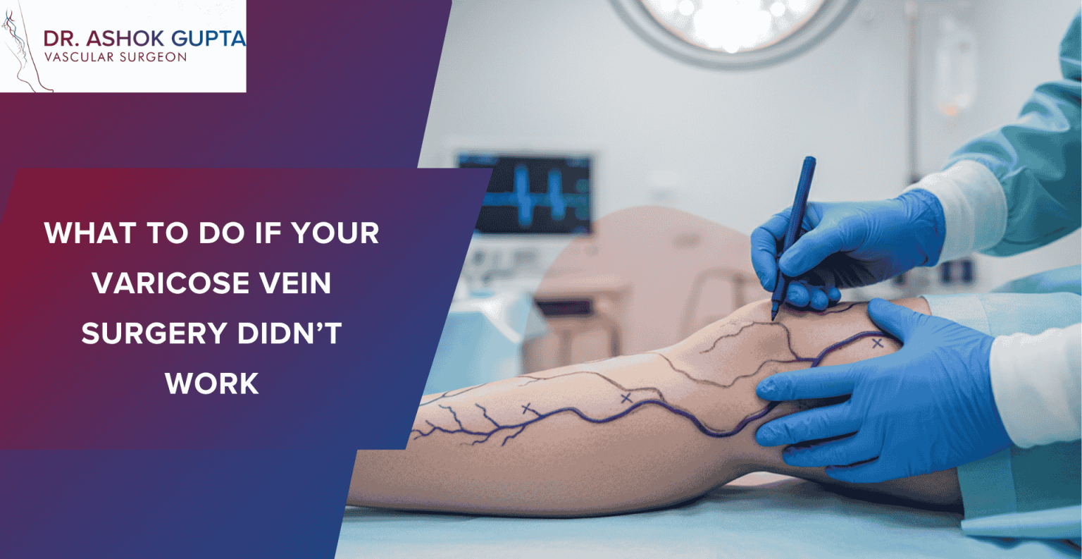 Dilated Tortuous Blue Veins In Legs: Causes And Treatment
